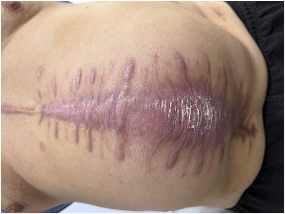 Frontiers Publishing Partnerships | Implementation of Modified Enhanced ...