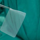 IPOM ventral hernia repair - Pros & Cons | Frontiers Publishing ...