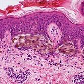 Dermatopathology and Associated Laboratory Investigations in the Study ...